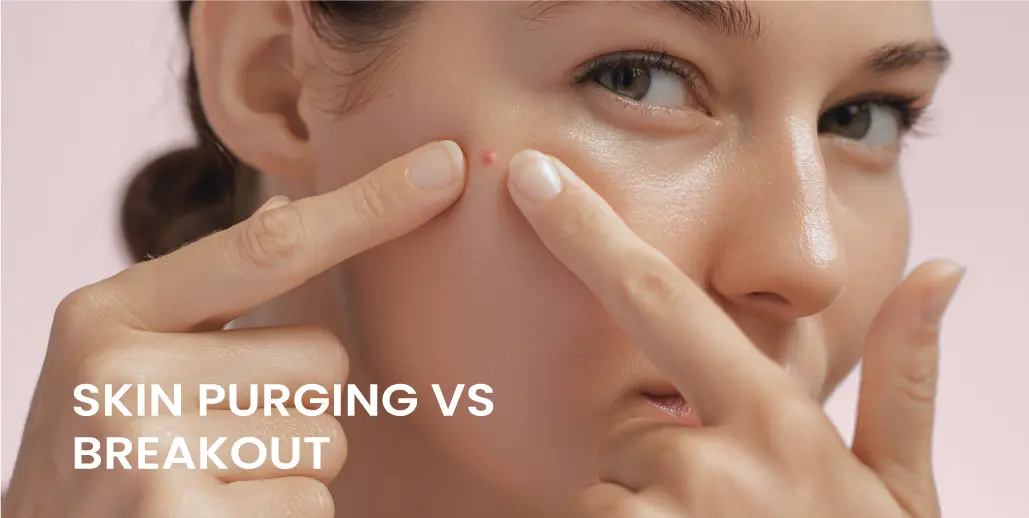 Skin Purging vs Breaking Out What the Real Different?